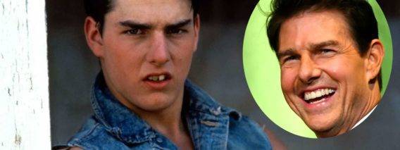 Top 10 Celebrities With The Worst Teeth (That Are Better Now)